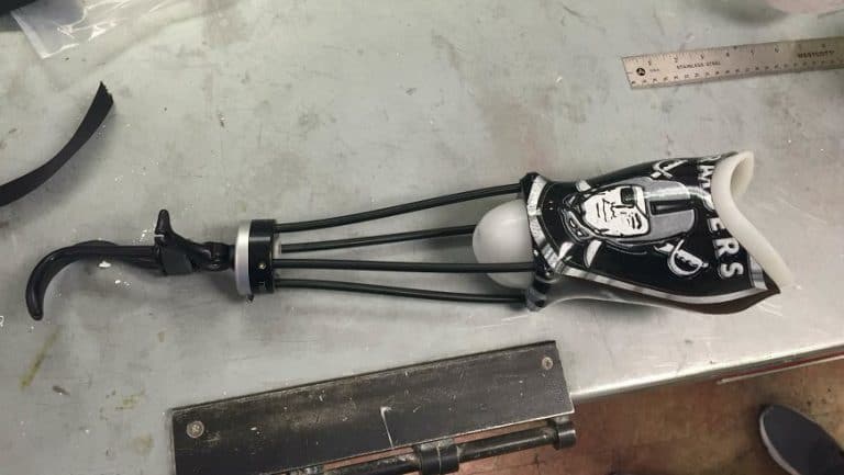 Below Elbow Prosthetics | Evolve Prosthetics & Orthotics