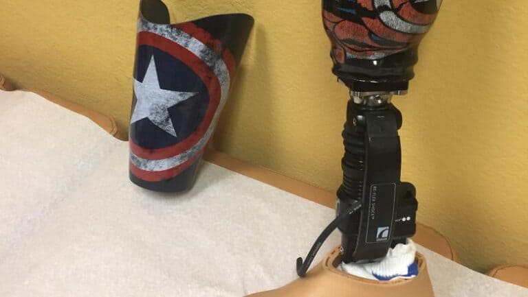 Microprocessor Feet & Knees In Las Vegas | Evolve Prosthetics & Orthotics