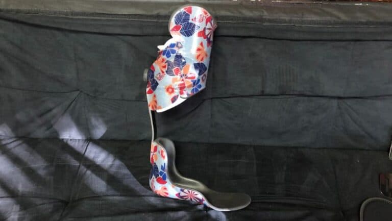 Allard AFO & Prosthetics In Las Vegas | Evolve Prosthetics & Orthotics