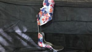 What Is Drop Foot? | Evolve Prosthetics & Orthotics