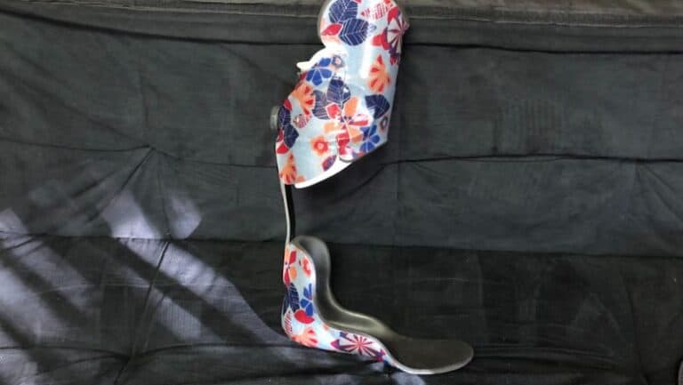 What Is Drop Foot? | Evolve Prosthetics & Orthotics