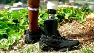 WillowWood Prosthetics | Evolve Prosthetics & Orthotics